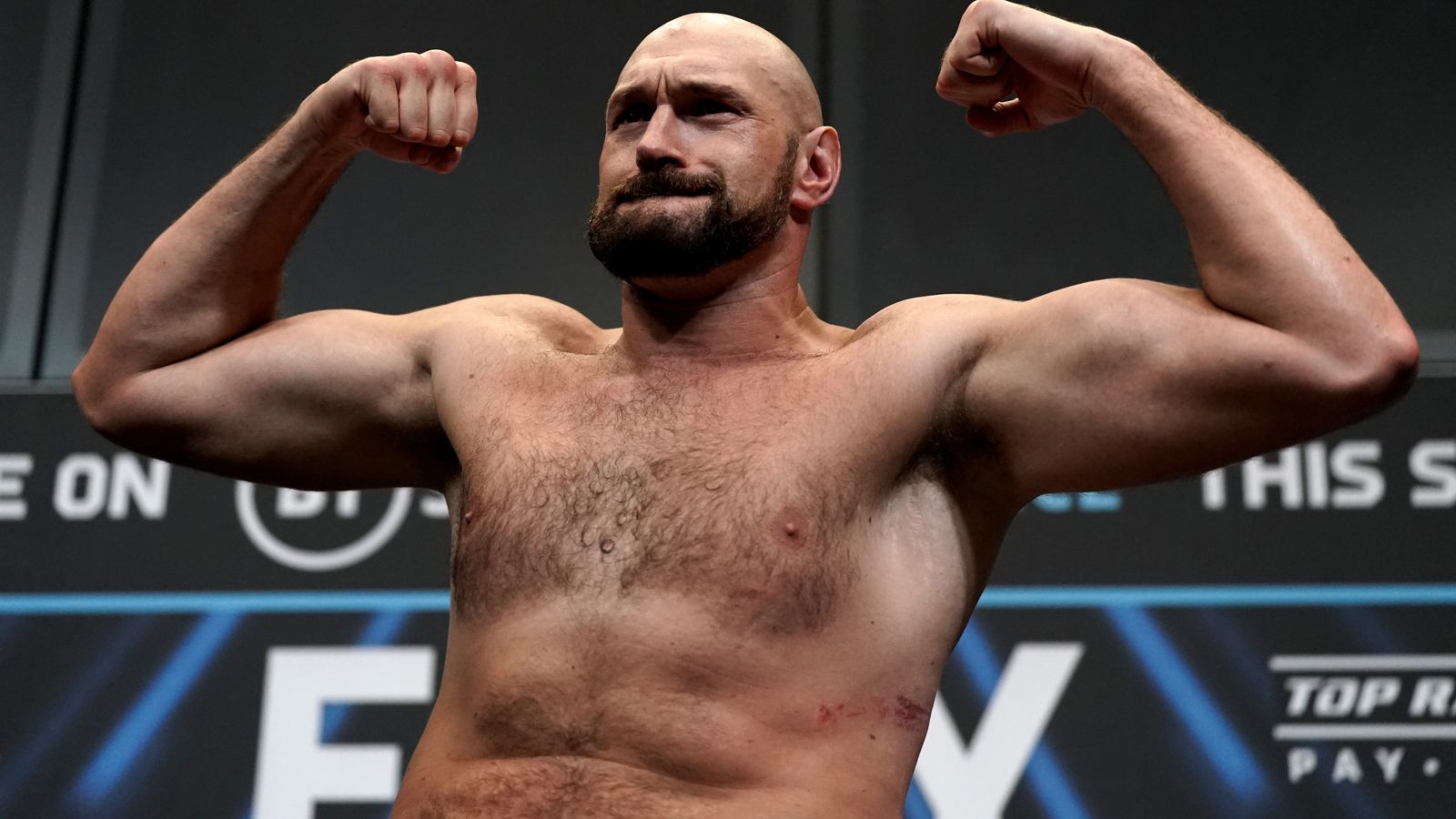 Tyson Fury speaks on his future; How long could he go? | Official ...